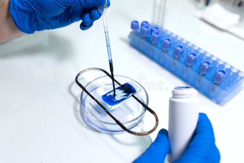Scientist Prepare Blood Sample for Research on Microscope. Placing ...
