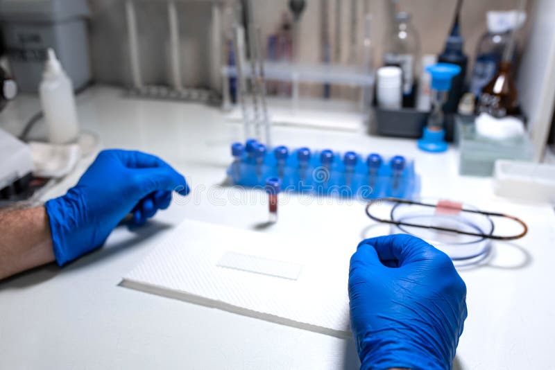 Scientist Prepare Blood Sample for Research on Microscope. Placing ...