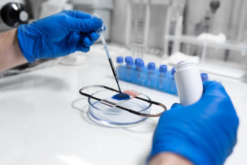 Scientist Prepare Blood Sample for Research on Microscope. Placing ...