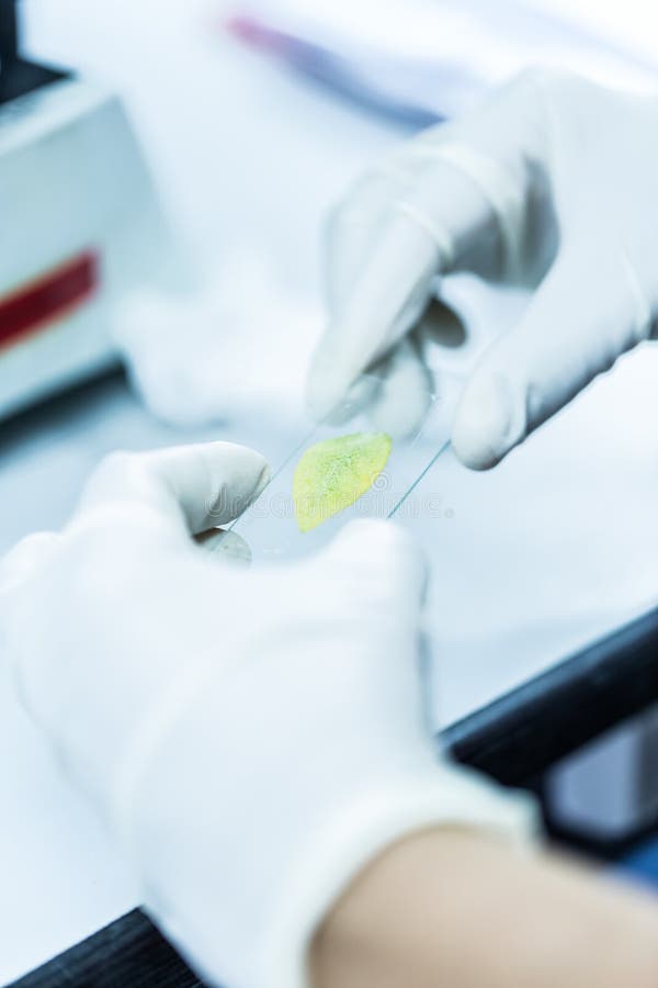 Scientist Prepare Blood Sample for Research on Microscope. Placing ...