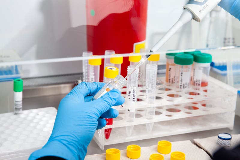Scientist Preparing Blood Samples for Karyotype and Fluorescence in ... Scientist Preparing Blood Samples for Karyotype and Fluorescence in ...