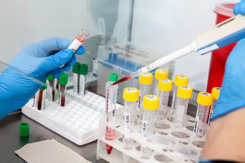 Scientist Preparing Blood Samples for Karyotype and Fluorescence in ... Scientist Preparing Blood Samples for Karyotype and Fluorescence in ...