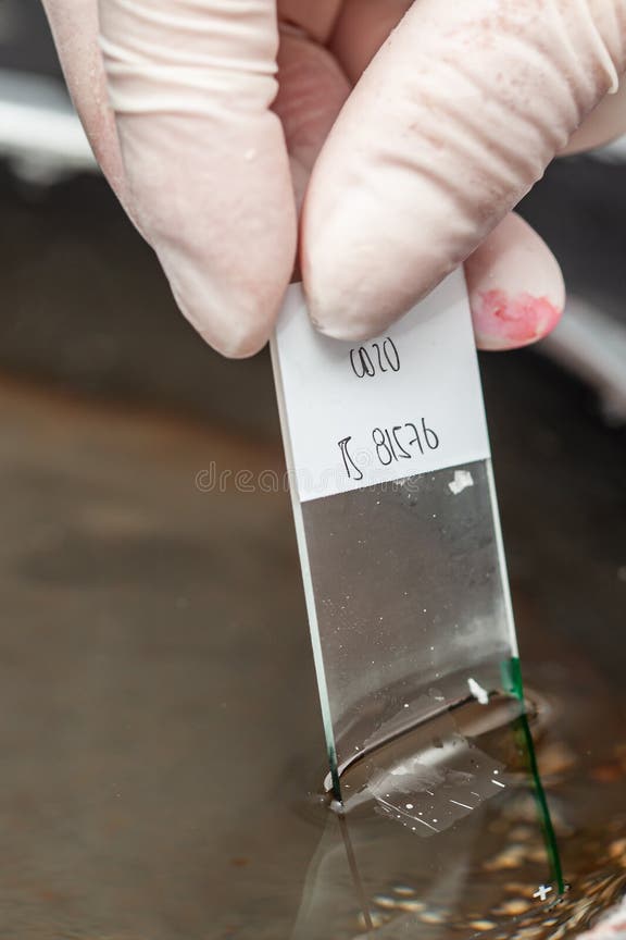Scientist Preparing a Paraffin Embedded Tissue for Pathology Analysis ...