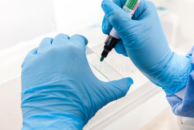 Scientist Preparing Slides with Paraffin Embedded Tissue Samples for ...