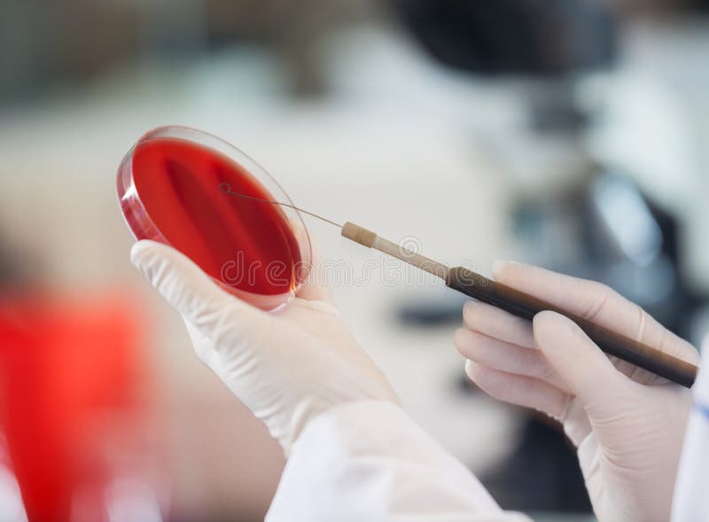 The inoculating loop stock image. Image of biological - 158135695