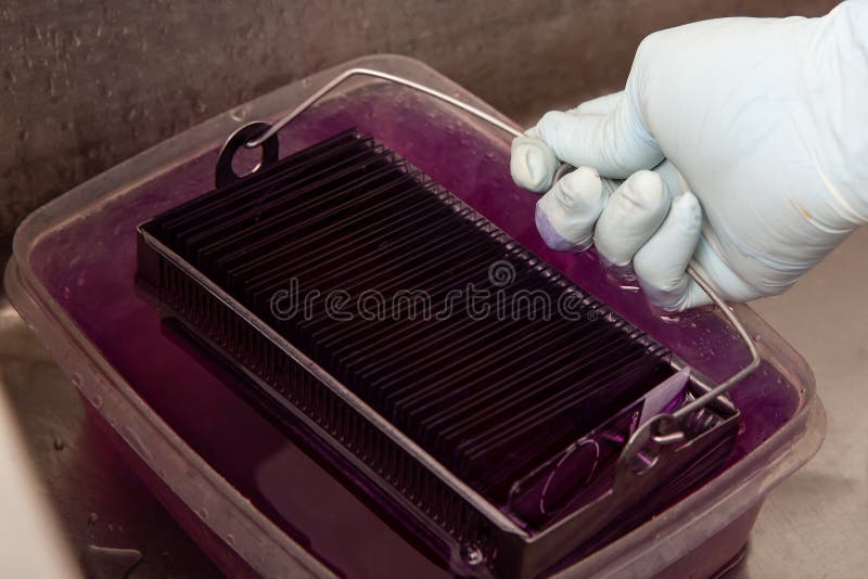 Scientist Staining Microscope Slides for Cytology Studies in the ...