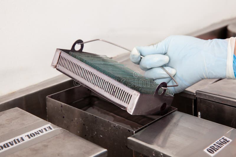 Scientist Staining Microscope Slides for Cytology Studies in the ...