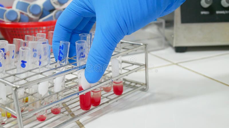 Scientist Testing Crossmatching in Laboratory Stock Photo - Image of ...