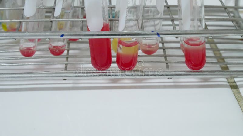 Scientist Testing Crossmatching in Laboratory Stock Image - Image of ...