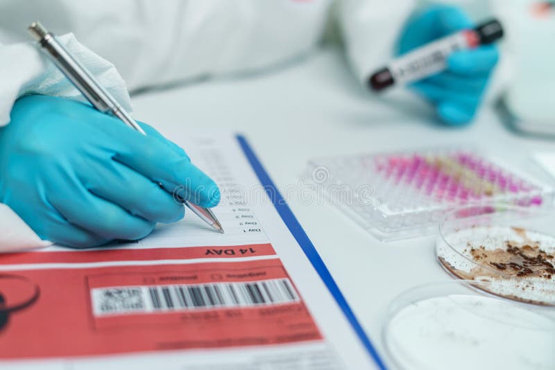 Blood Test Samples Tube, Reagent Testing Tube and Swab Collection Kit ...