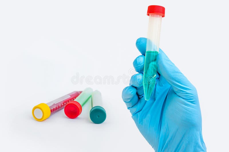 Test-tube with Positive Blood Test on CORONAVIRUS Stock Photo - Image ...
