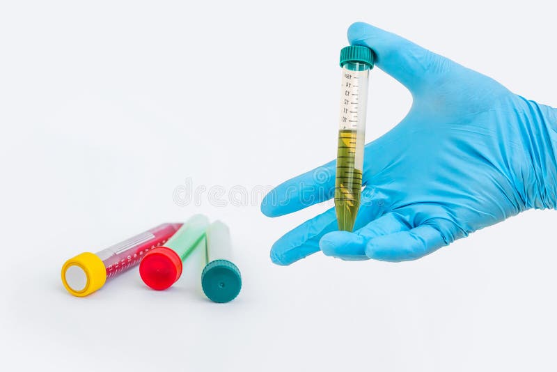 Scientists Hand Holding a Test-tube with Green Liquid Stock Photo ...