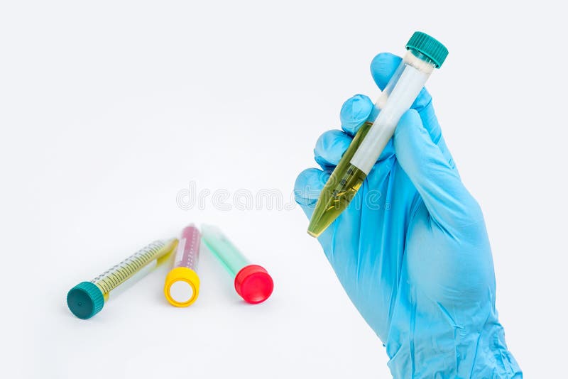 Scientists Hand Holding a Test-tube with Green Liquid Stock Photo ...