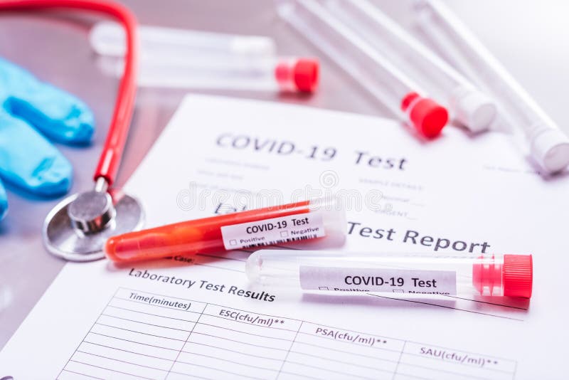 Scientists Studying a Cure for Covid Disease Caused by a Virus, Testing ...