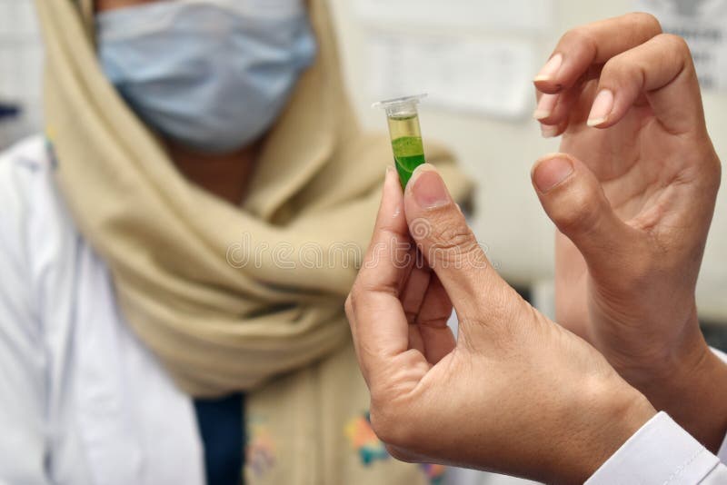 DNA Extraction Procedure in Laboratory. Stock Image - Image of ...