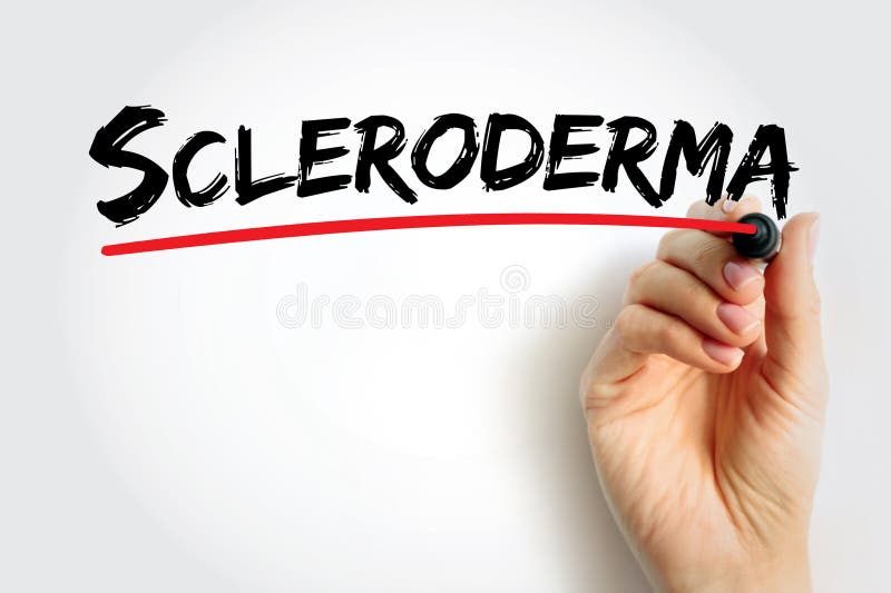 Scleroderma - Autoimmune Connective Tissue and Rheumatic Disease that ...