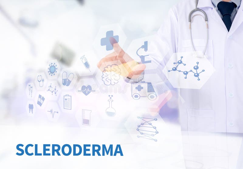 Scleroderma stock image. Image of contraction, connective - 70656073