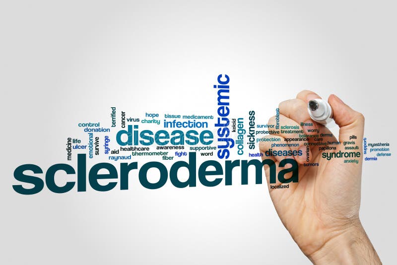 Scleroderma word cloud stock photo. Image of care, disease - 90731768