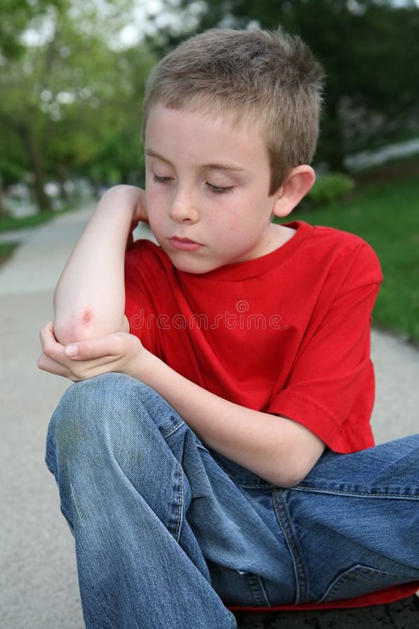 Scraped Arm stock image. Image of pain, looks, learning - 85210459