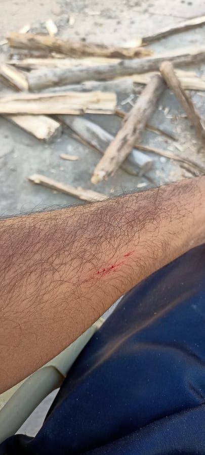 Scratch while Breaking Fire Wood Stock Image - Image of limb, footwear ...