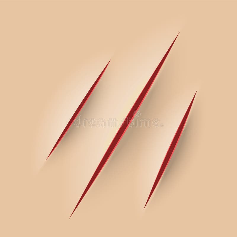 Scratch on skin. Red blood stock vector. Illustration of scar - 161298810