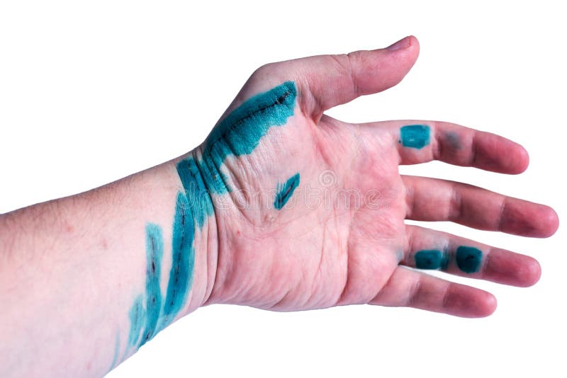 416 Medical Scratched Stock Photos - Free & Royalty-Free Stock Photos ...