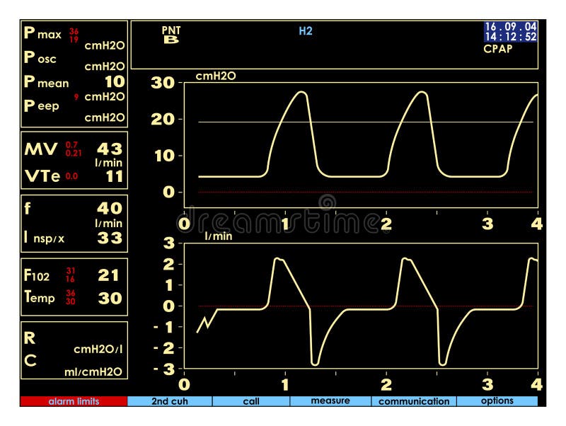 Screen, Monitor with Signs of the Artificial Lung Ventilation Device in ...