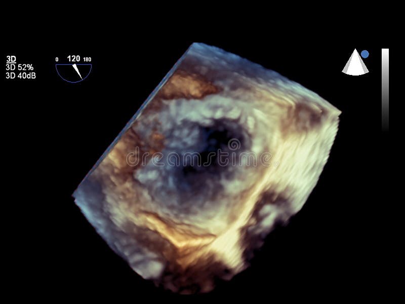 Modern 3D echocardiography stock illustration. Illustration of echo ...