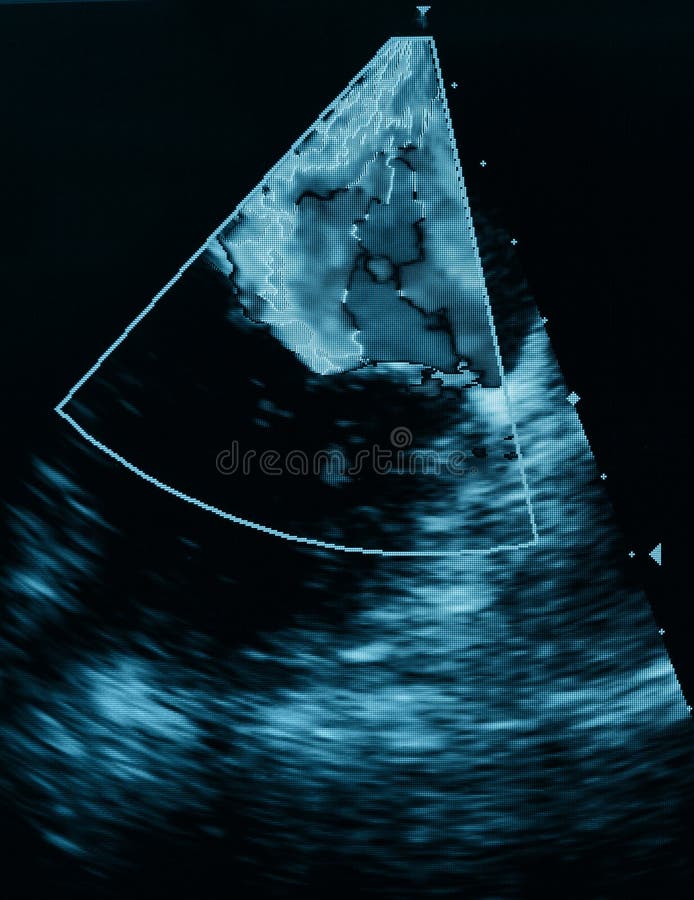 Screen Ultrasound Machine. Symbol Diagnostics in Healthcare. Stock ...