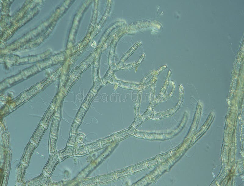 Sea water red algae stock image. Image of wall, cell - 194441041