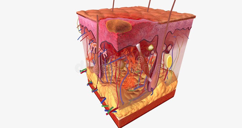 A Second Degree Burn Will Affect the Epidermis and Part of the Dermis ...
