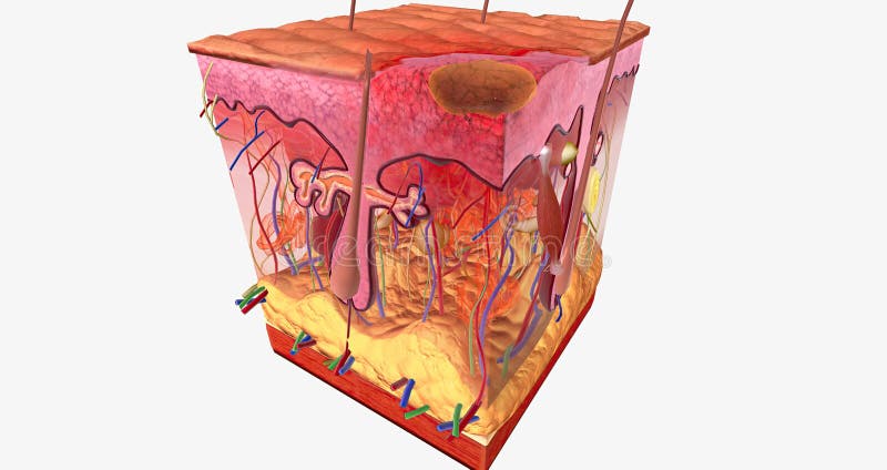 A Second Degree Burn Will Affect the Epidermis and Part of the Dermis ...