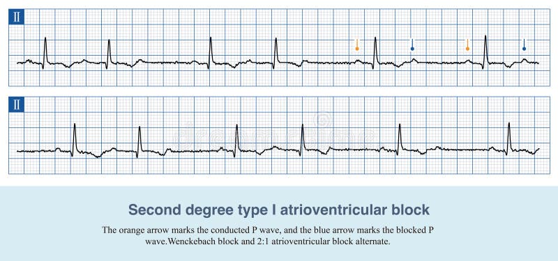 Pr Intervals Stock Photos - Free & Royalty-Free Stock Photos from ...