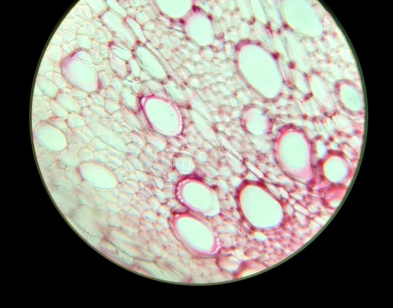 Secondary Root Structure, Permanent Microscopic Photography Stock Image ...