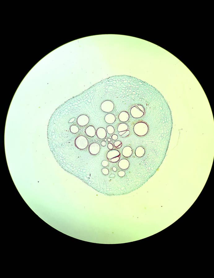 Secondary Structure of Pumpkin Root, Microscopic Photography Stock ...