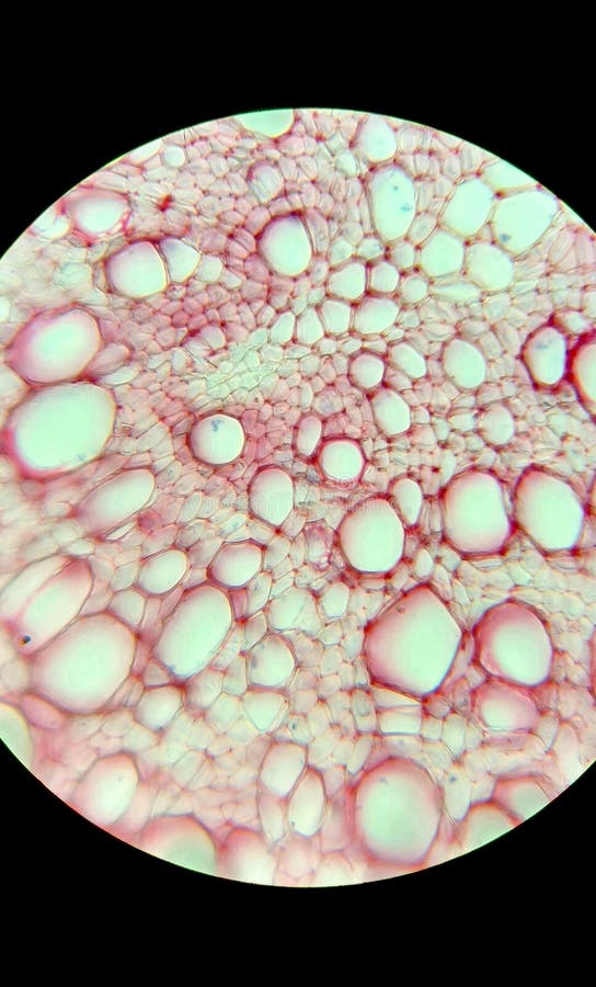 Secondary Root Structure, Permanent Microscopic Photography Stock Photo ...