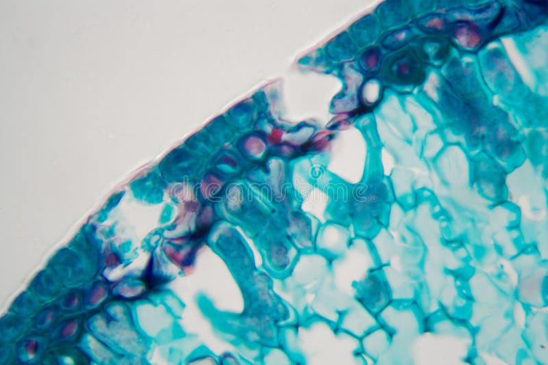 Conifer Needle with Environmental Damages Under a Microscope Stock ...