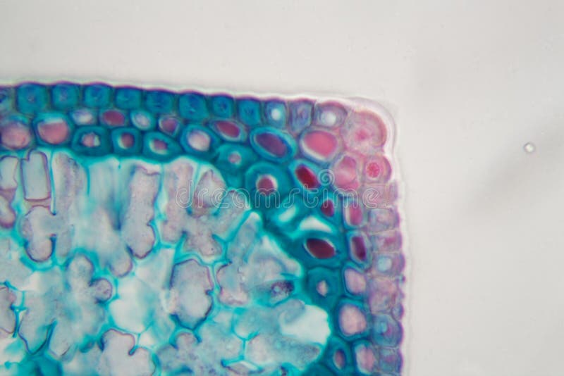 Conifer Needle with Environmental Damages Under a Microscope Stock ...