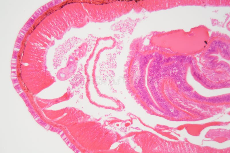 Section D'un Ver De Terre Sous Le Microscope Image stock - Image du ...