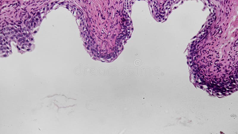 Human Bladder in Section Void Filmed Under Microscope 100x with Oblique ...