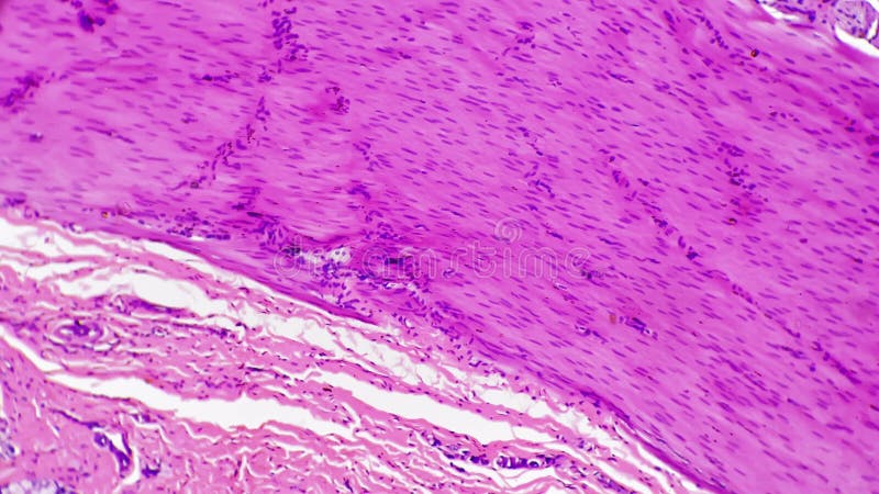 Duodenum of the Human Being in Section Shown Under Microscope with 40x ...