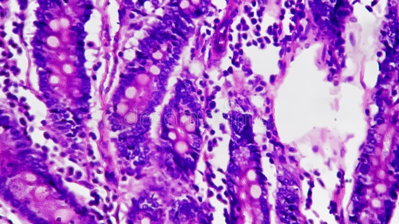 Section of Human Duodenum in High Magnification 400x Filmed Under ...