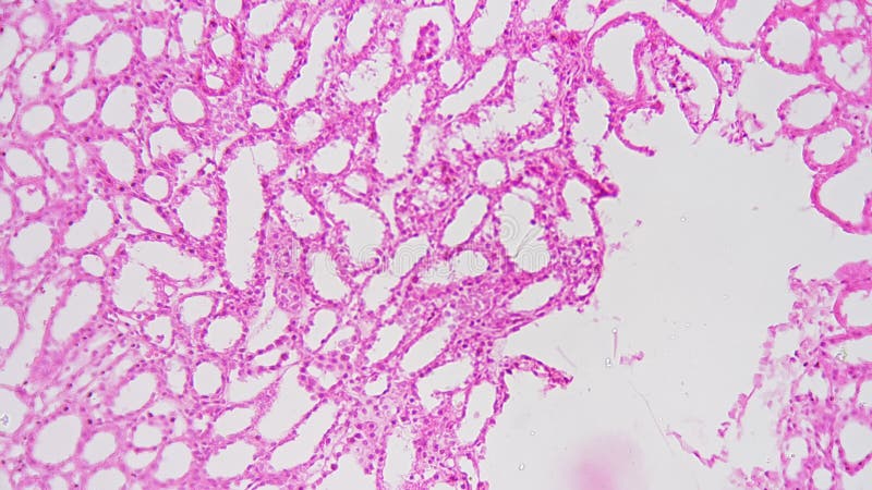 Section of Human Kidney Section Filmed Under Light Micrograph 200x on ...