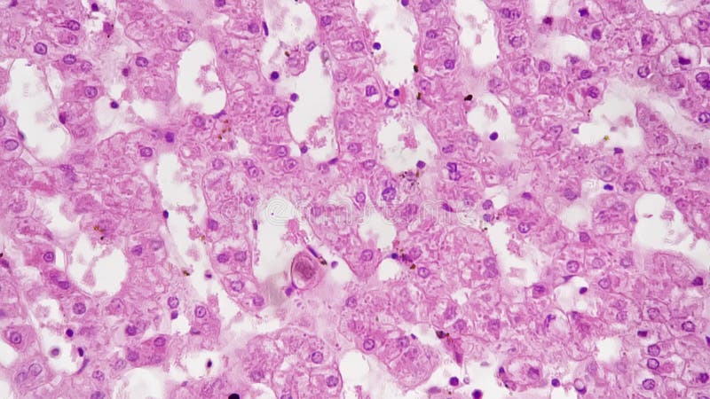 Section of Human Liver Under Microscope with 400 Times Magnification on ...