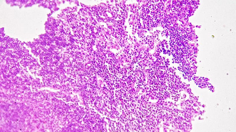 Lymph Node in Section Magnified Under Microscope in 400x Times on ...