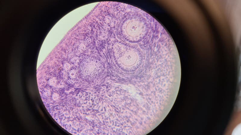 Mammalian Ovary Under a Microscope Stock Photo - Image of membrane ...