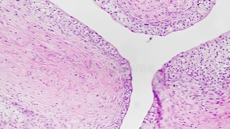 Transitional Epithelium of Man in Section Filmed Under Microscope 40x ...