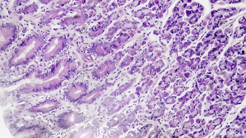 Stomach Fundic Portion in Section Filmed Under Microscope 400x on ...