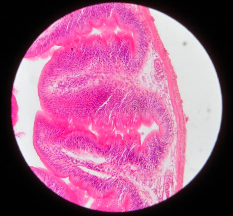 Intestinal Wall Model Labeled Stock Photos - Free & Royalty-Free Stock ...