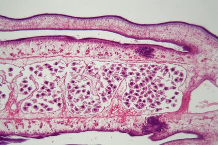 Segment of a Tapeworm Body Proglottid Stock Photo - Image of parasites ...
